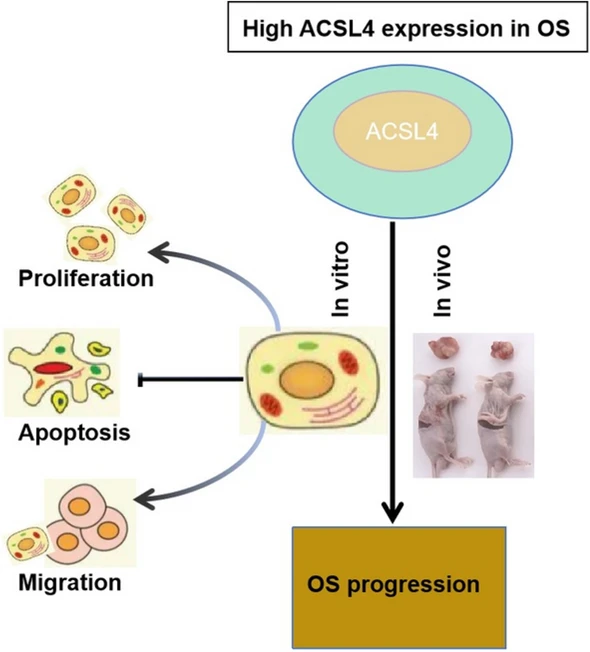 ACSL4 Accelerates Osteosarcoma Progression via Modulating TGF-β/Smad2 ...